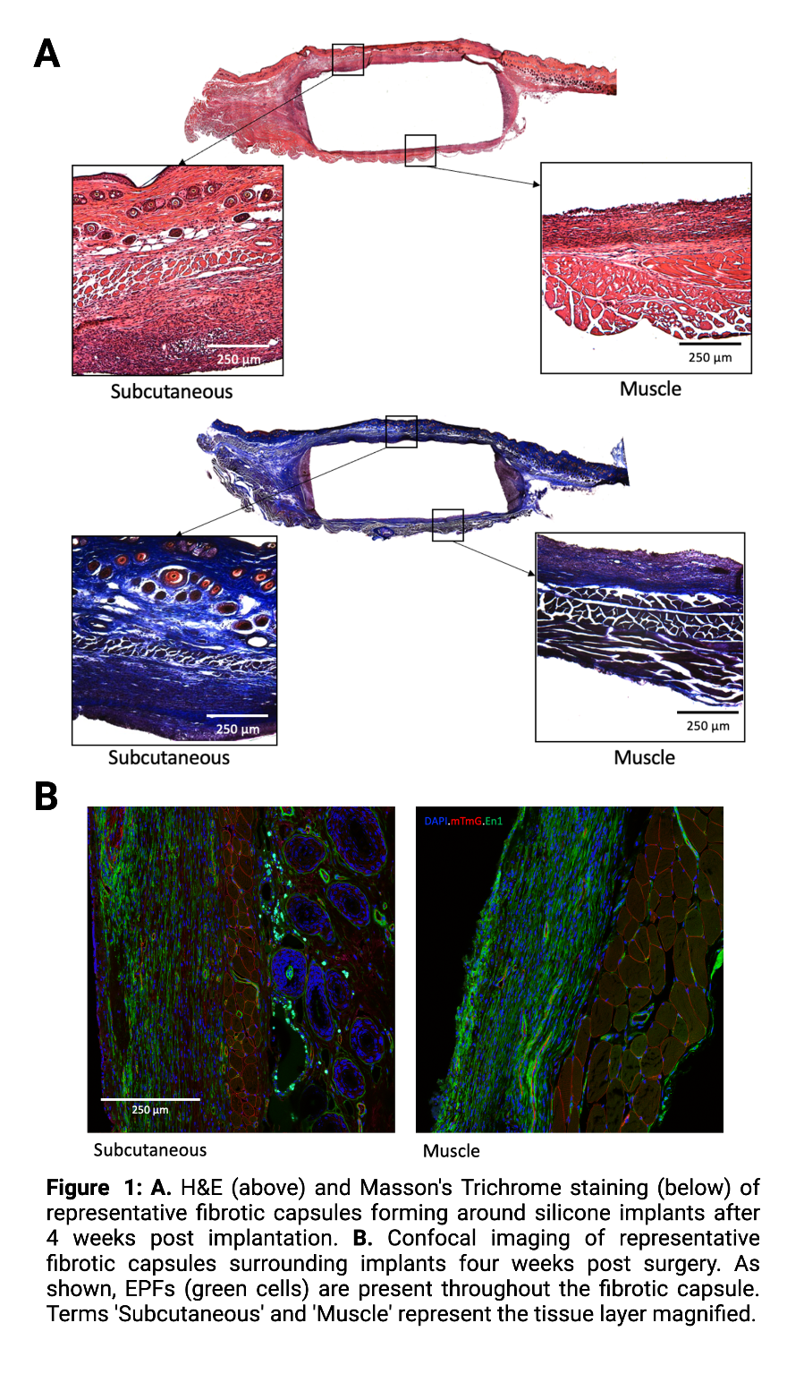 19 07 Identification Of Fibroblast Subpopulations Within Fibrotic Capsule During Foreign Body