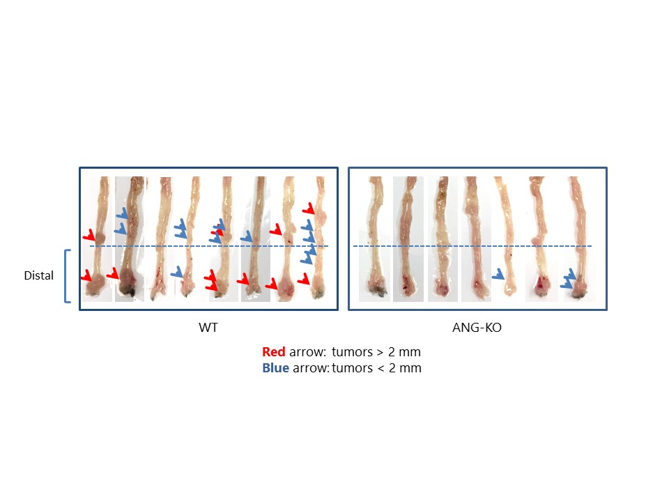 10.02 Angiogenin Regulates Tumor Growth via PKD and COX-2 in a Mouse ...